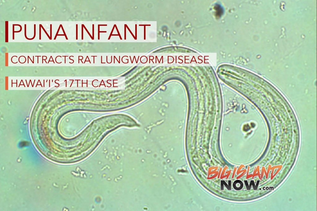 Hawai‘i’s 17th Rat Lungworm Case Found in Puna District : Big Island Now