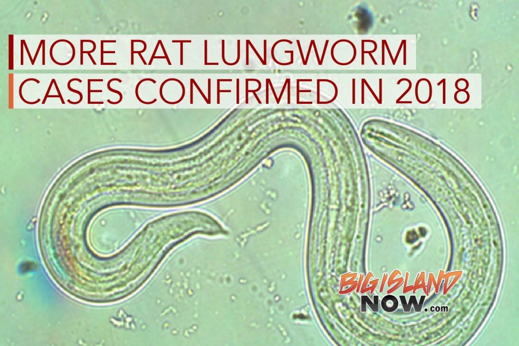 Hawai‘i DOH Confirms 2 More Big Island Rat Lungworm Cases : Big Island Now