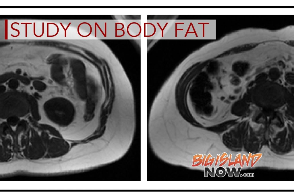 STUDY: Japanese Americans are Predisposed to Excess Body Fat : Big ...