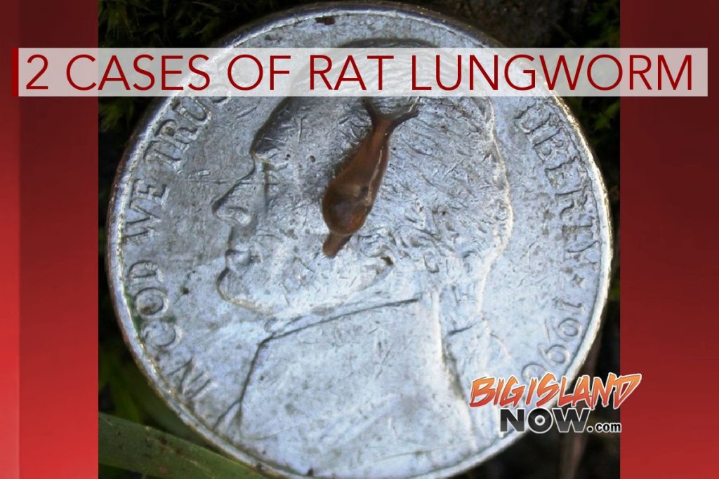 DOH Confirms 2 More Cases of Rat Lungworm Disease : Big Island Now