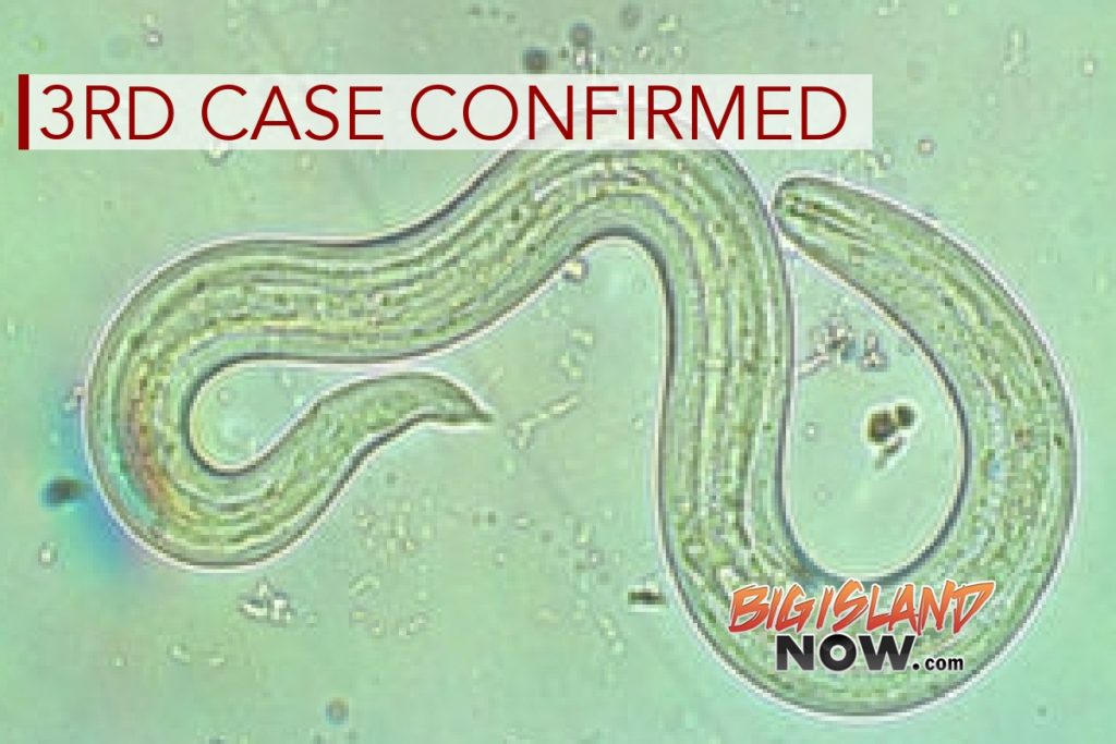 Hawai‘i DOH Confirms 2019’s 3rd Rat Lungworm Case on Hawai‘i Island ...