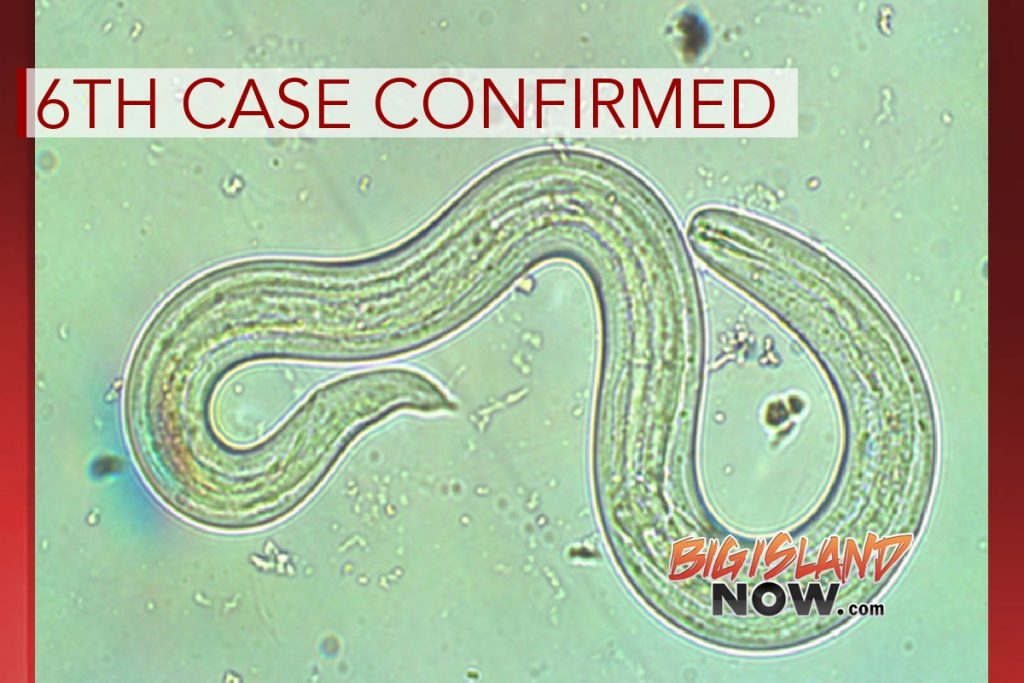 6th Case Rat Lungworm Disease Confirmed in Hawai‘i Island Visitor : Big ...