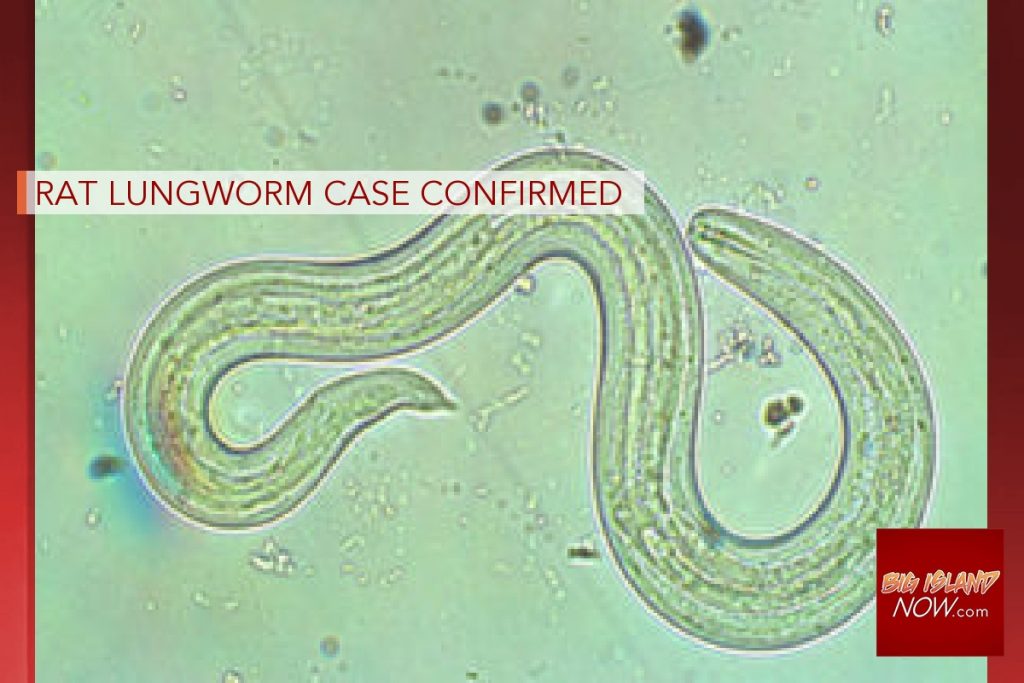 DOH Confirms Ninth Case of Rat Lungworm : Big Island Now
